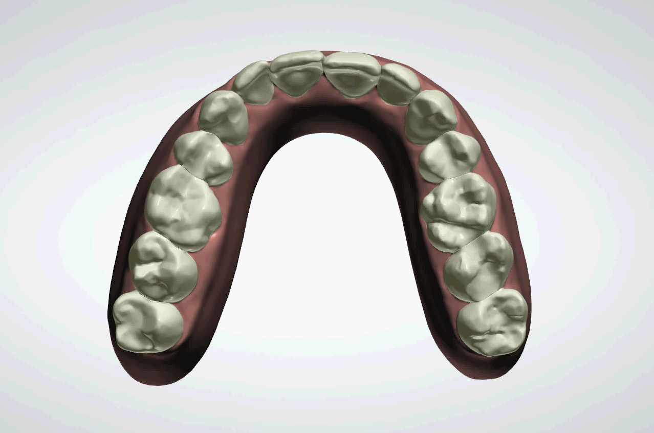Upper Occlusal View – XLUR